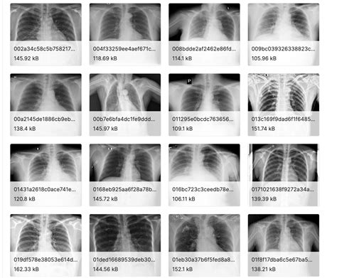 Yolov5 Pytorch Tutorial How To Use Yolov5 In Pytorch