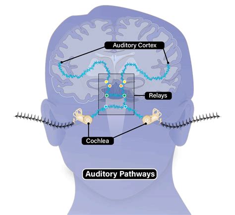 Auditory 