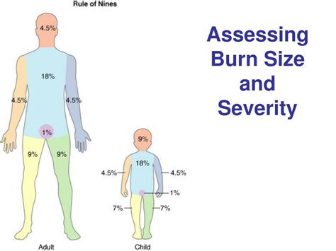 Ppt Burns Powerpoint Presentation Free Download Id6692614