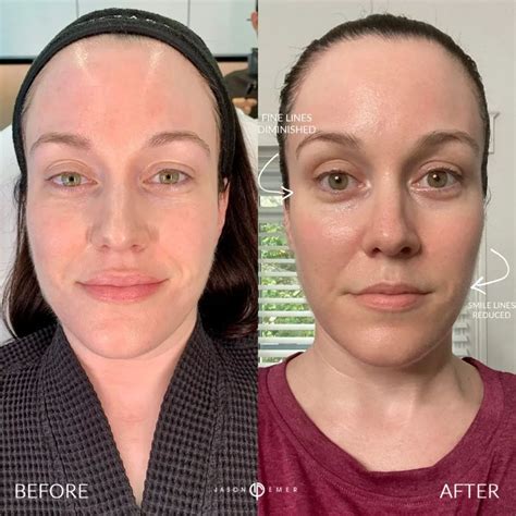 Moxi Cosmetic Dermatologist Dr Jason Emer