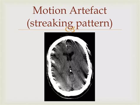 Neuro Radiology Neuroimaging Pptx