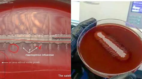 Macconkey Agar Composition Uses Colony Characteristics Biology
