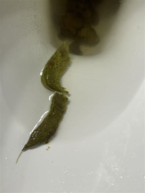 Why Is My Poop Green Like Grass At Dorothy Lim Blog