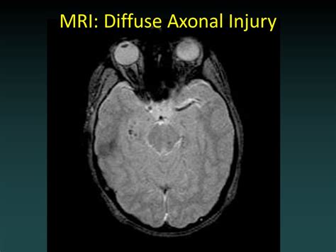 Introductory Neuroimaging What You Need To Know At 3 Am And Some Cool Stuff Online Presentation