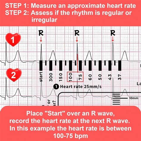 Ecg Ruler Ecg 7 Step Ruler Ecg 7 Step Ruler For Ecgekg