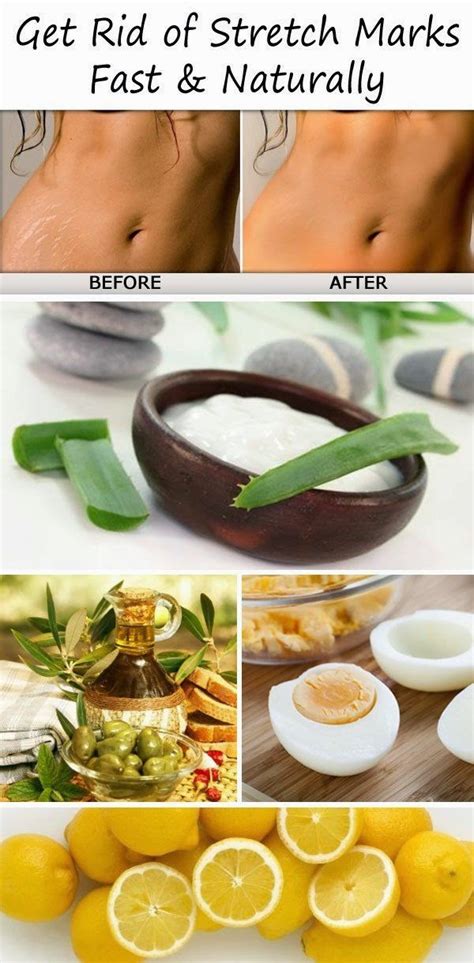 How To Get Rid Of Stretch Marks Fast Natural Ways To Get Rid Of Stretch Marks Noor LifeStyle