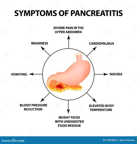What Is Enlarged Pancreas At Jamie Spinelli Blog