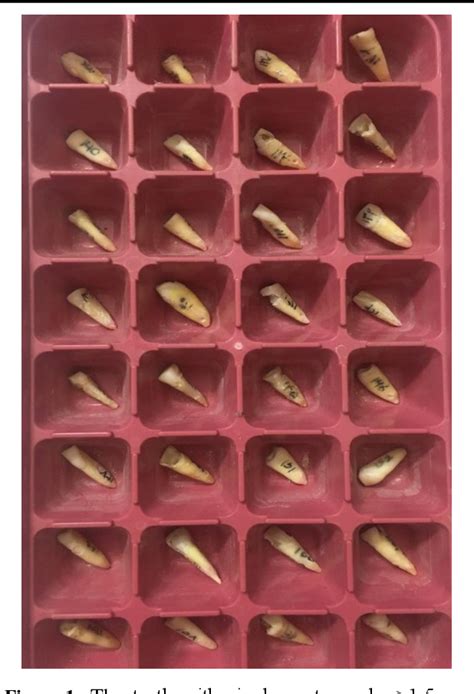 Figure 1 From Comparison Of The Accuracy Of Cbct Images And Apex Locator In Detection Of