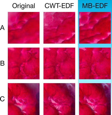 Details Of The Texture Estimation Comparison From Fig 7 Download Scientific Diagram
