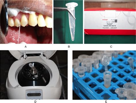 Microbial Sampling And Processing A Plaque Sample Collection Using A Download Scientific