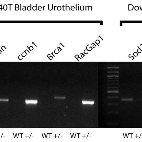 Confirmation Of Microarray Data Rt Pcr Was Performed Using The Cdna