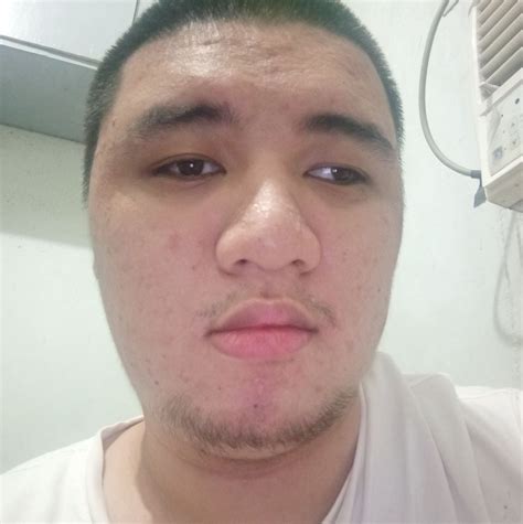 Nicos Lim Iii
