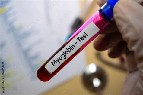 Myoglobin Test With Blood Sample Top View Isolated On Office Desk