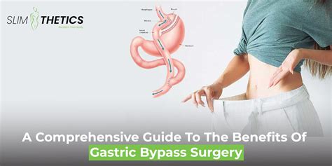 Guide To The Benefits Of Gastric Bypass Surgery