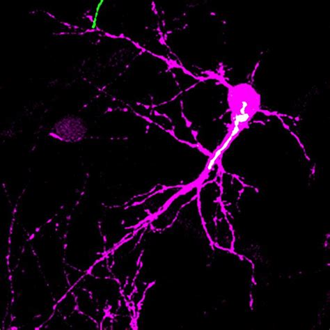 Uncovering How The Golgi Apparatus Impacts Early Postnatal Neuron