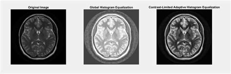 Quick Guide To Histogram Equalization For Clearer Images
