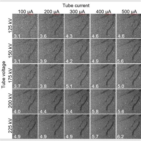 Influence Of Tube Voltage And Current On X Ray Ct Images Using A