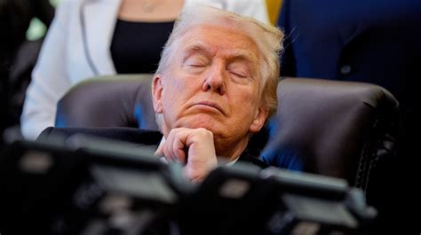 How Donald Trump 79 Turned Bruises And Cankles Into A Full On Health