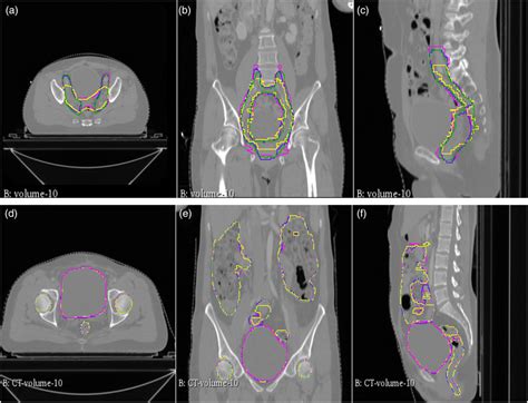 typical automatic delineation results from 3d models a c clinical download scientific