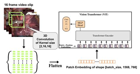 Must Multi Scale Transformers For Surgical Phase Recognition Ai