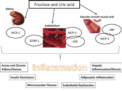 Potential Role Of Inflammatory Molecules In Fructoseuric Acid Related