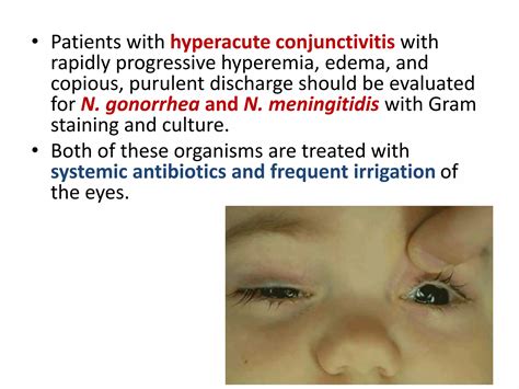 Diagnosis And Management Of Pediatric Conjunctivitis Pptx Ear Nose
