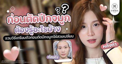ตัดปีกจมูกสไตล์ Emma Clinic ลดปีกจมูกได้จริงไหม • Emma Clinic