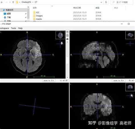Chat Gpt论文润色 柳叶刀顶刊：定制化科研任务影像组学实操内训 知乎