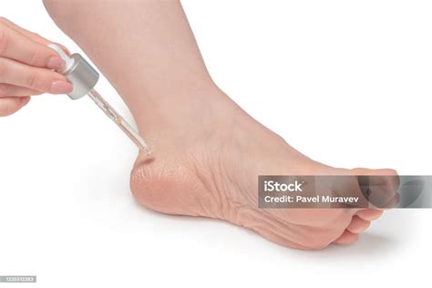 발 뒤꿈치의 건조한 피부 건조한 발 피부 치료 고립 된 흰색 배경에 대한 여성 관심 간호사에 대한 스톡 사진 및 기타 이미지 간호사 거친 건강 진단 Istock