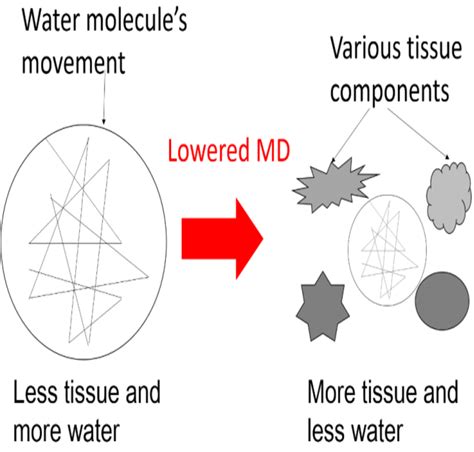 Schema Of Lower And Higher Mean Diffusivity MD And Association With Download Scientific