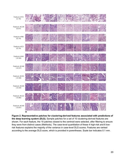 Interpretable Survival Prediction For Colorectal Cancer Using Deep