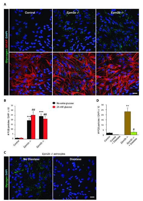 Primary Astrocytes From Ld Mouse Models Accumulate Polyglucosan Download Scientific Diagram