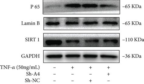 Angptl4 Knockdown Regulated Ecm Degradation And Inflammation Through