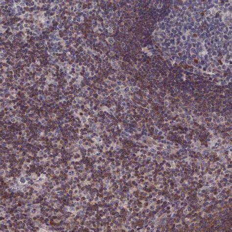 Anti Il7 Human Protein Atlas Antibody