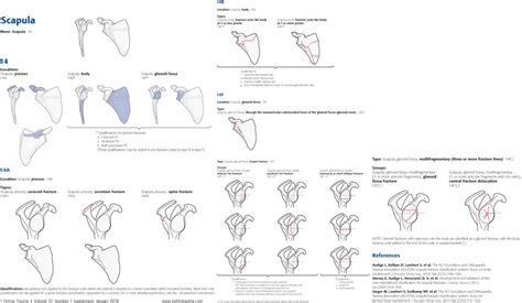 Scapula Fractures Clinical Tree Scapula Fractures Clinical Tree