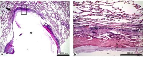 Panoramic View Of Hydatid Cysts In Camel Lung Tissues A The