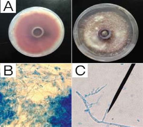 A Colony Of Fusarium Spp B Mycelium And Conidias C Conidia