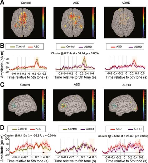 Predictive Coding In Autism Spectrum Disorder And Attention Deficit