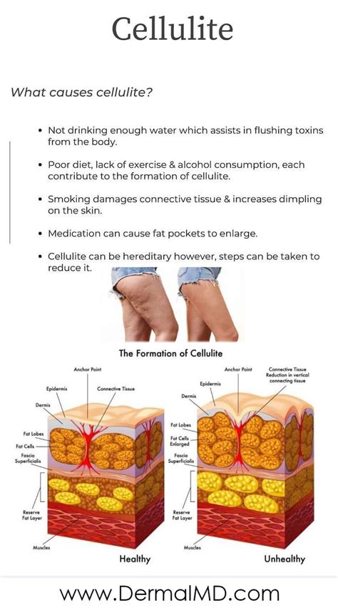 Cellulitis Causes