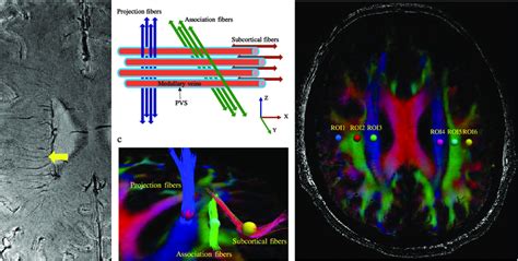 illustration of the diffusion tensor image analysis along the