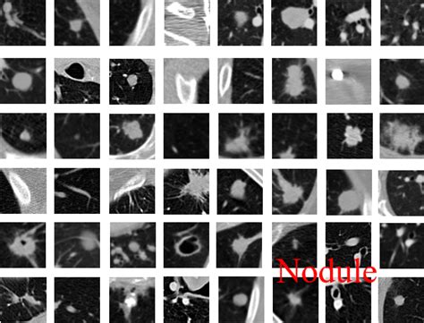 samples of lung nodule and lung non nodule on luna16 dataset download