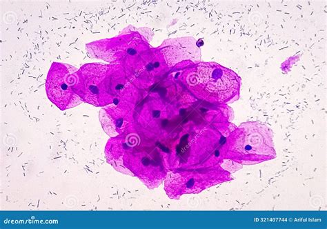 Buccal Smear Showing Bacteria On Cheek Cells Stock Image