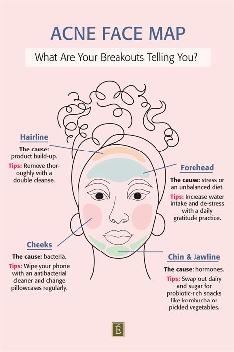 Acne Face Map What Are Your Breakouts Telling You Face Acne Face Mapping Acne Face Mapping