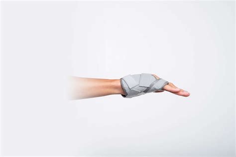 5th Metacarpal Fracture Orthosis Ref 28 Chrisofix