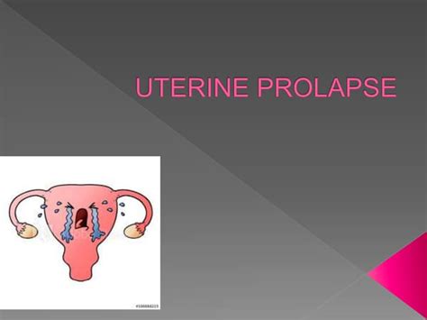 Retro Version Of Uterus Pptx