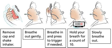 Can You Explain The Correct Inhaler Techniques Respiratory Therapist