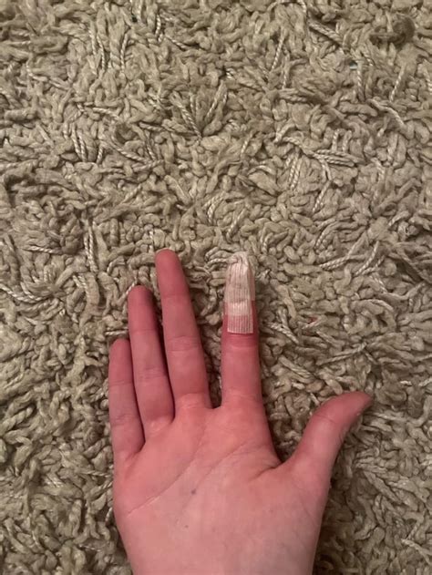 Is My Cut Infected Rdiagnoseme