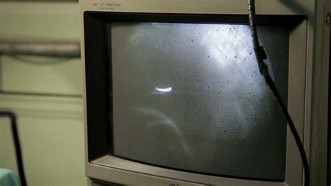 Urology Urological Examination Genitals Medical Camera Stock Footage