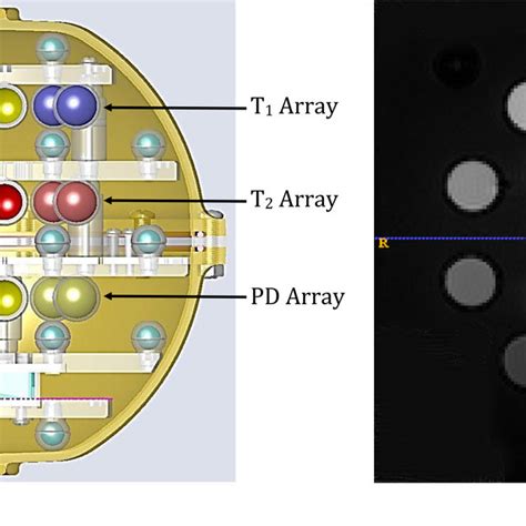 The Hpd Calibermri System Standard Quantitative Mri Qmri Phantom