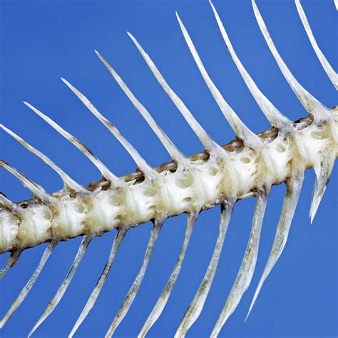 Dried Fish Bone Stuck In Throat At Dennis Chapman Blog